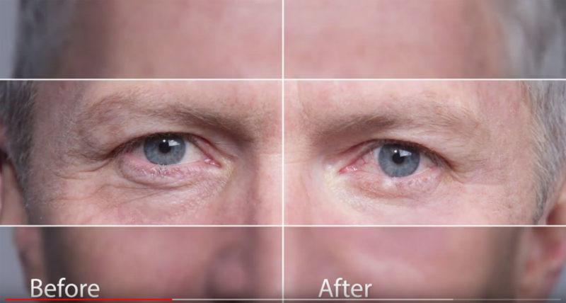 Instantly Ageless™ Before and After Photo Gallery, Jeunesse Global