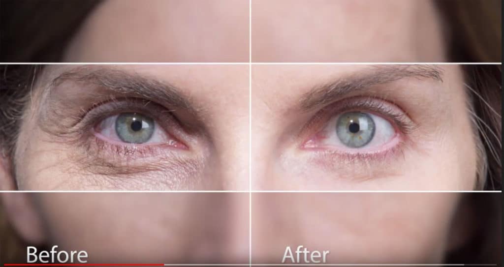 Instantly Ageless Vials, Under Eye Bags, Ageless Canada